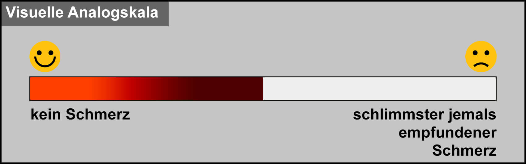 Grading- und Scoringsysteme für die Fazialisparese | Fazialis